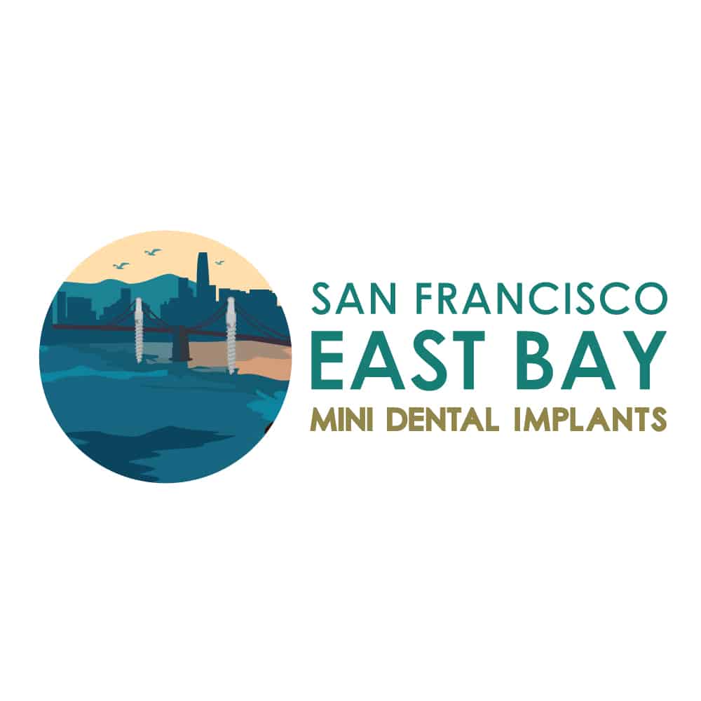 San Francisco East Bay Mini Dental Implants | Dr. Rose Magno